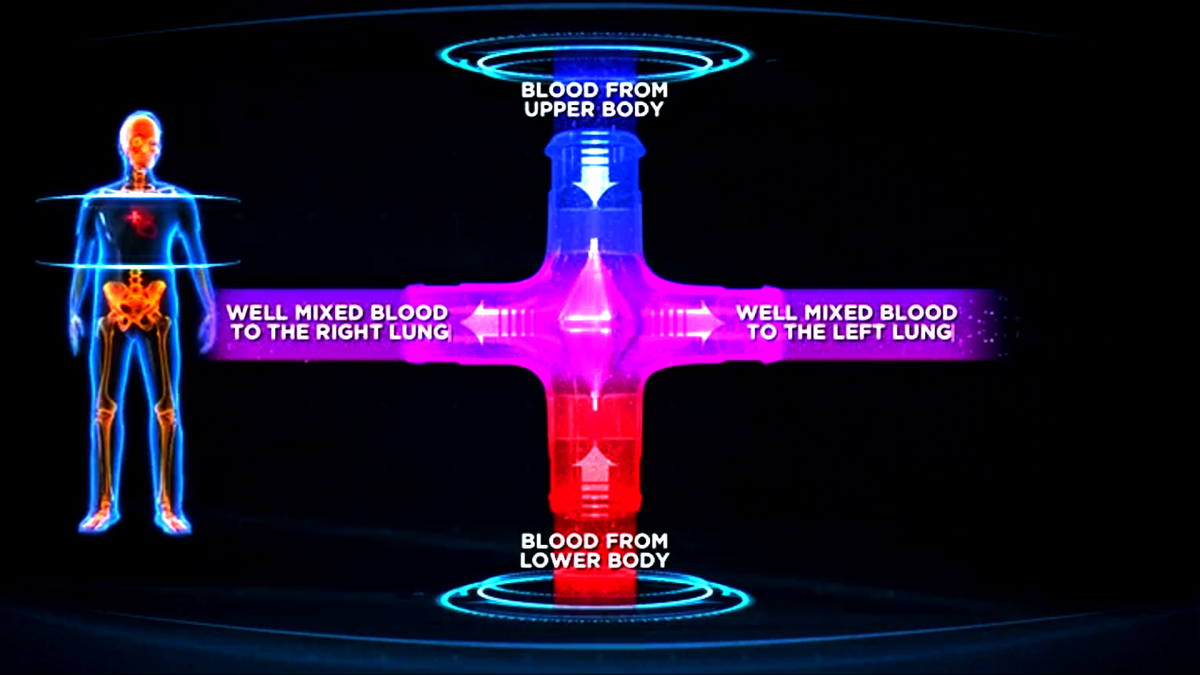 Nasa showcases potential breakthrough new heart pump motor using ...