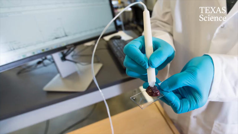 New 'pen' device accurately identifies cancer in 10 seconds | IBTimes UK