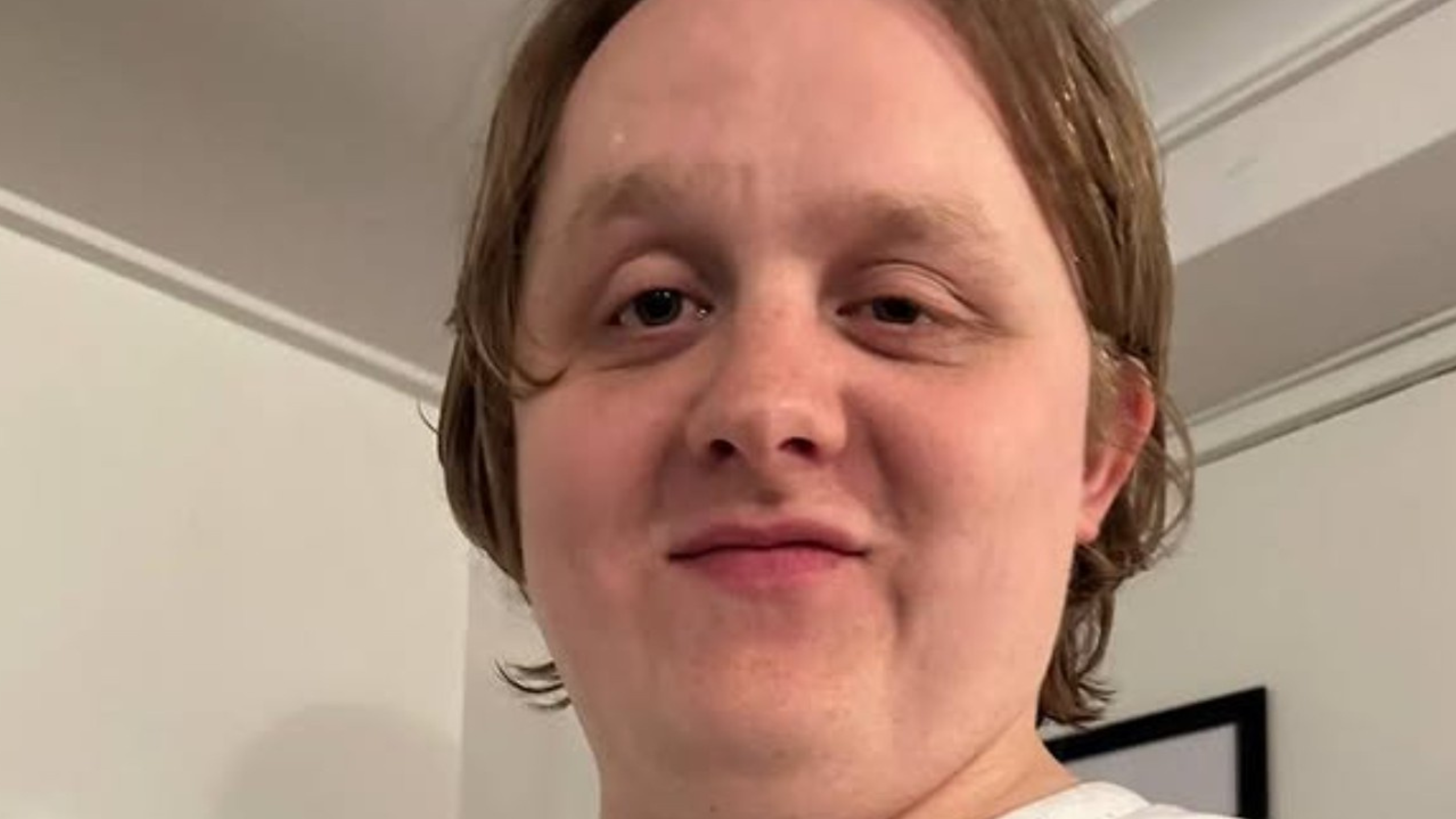 Lewis Capaldi and Tourette's: What It Is, How It Affected His Career ...