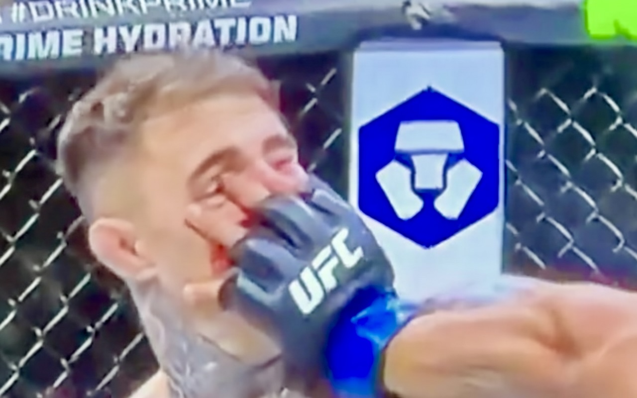 Tom Aspinall Left Half-Blind, Furious at UFC 321 Result — Will Fight ...