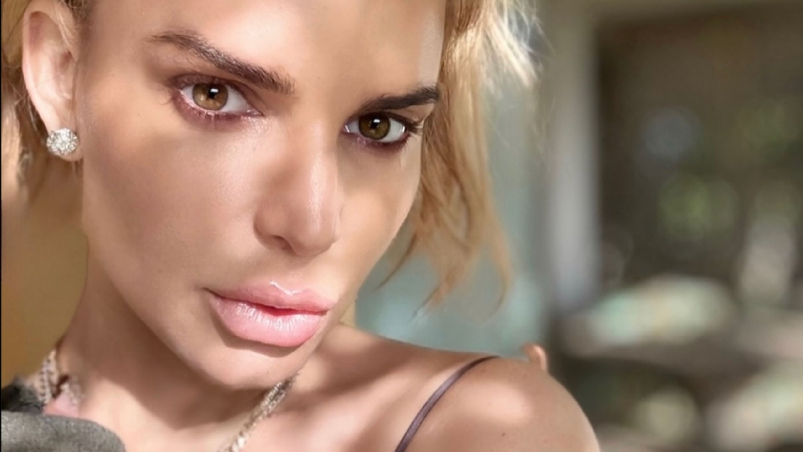 What Happened to Jessica Simpson's Face? Actress Gets 'Botched Plastic ...