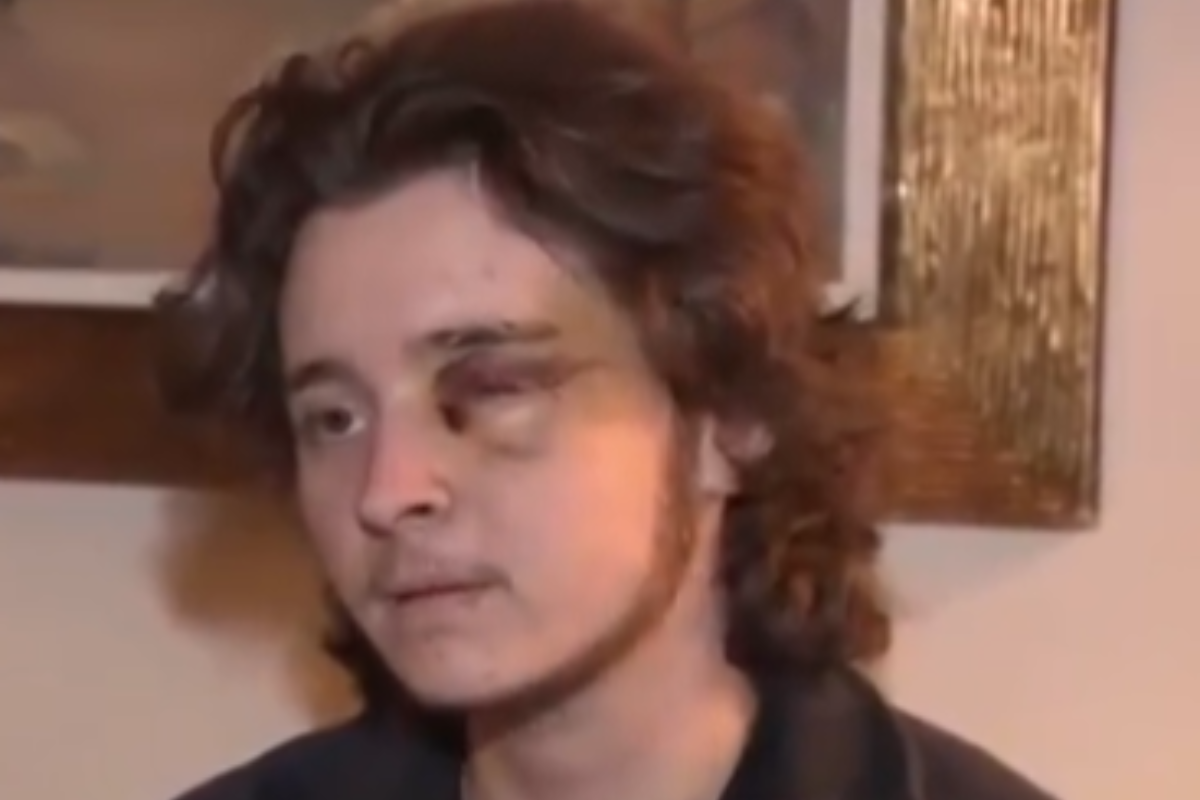 ICE Agent Shoots Protester in Face at Point-Blank Range, Leaving 21 ...