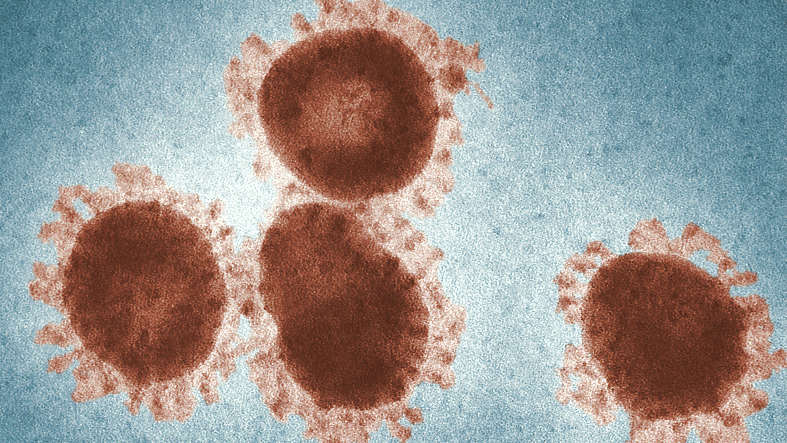 Nipah Virus Less Contagious, But More Deadly Than COVID-19: Symptoms ...