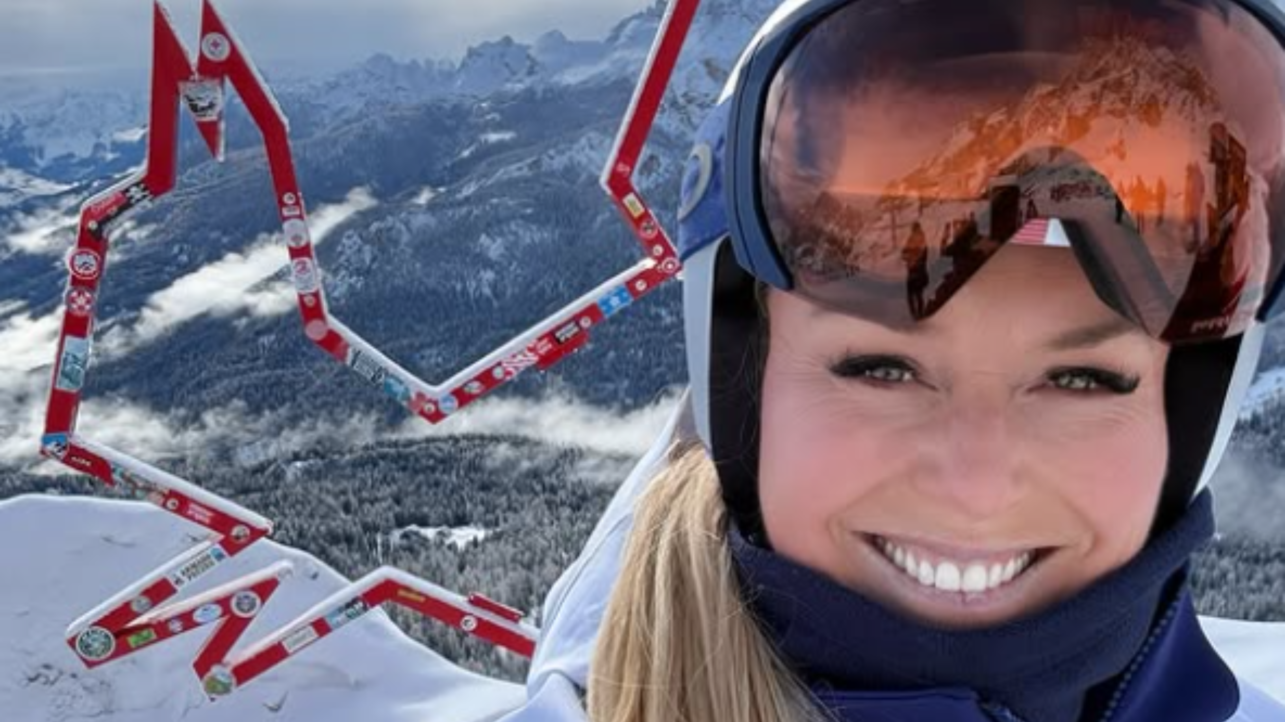 What Is a Complex Tibia Fracture? Inside Lindsey Vonn's Injury ...