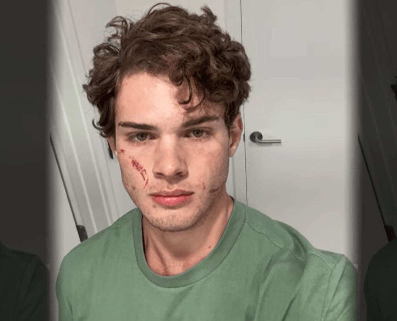 Clavicular's Family 'Very Concerned' After Suspected Overdose During ...