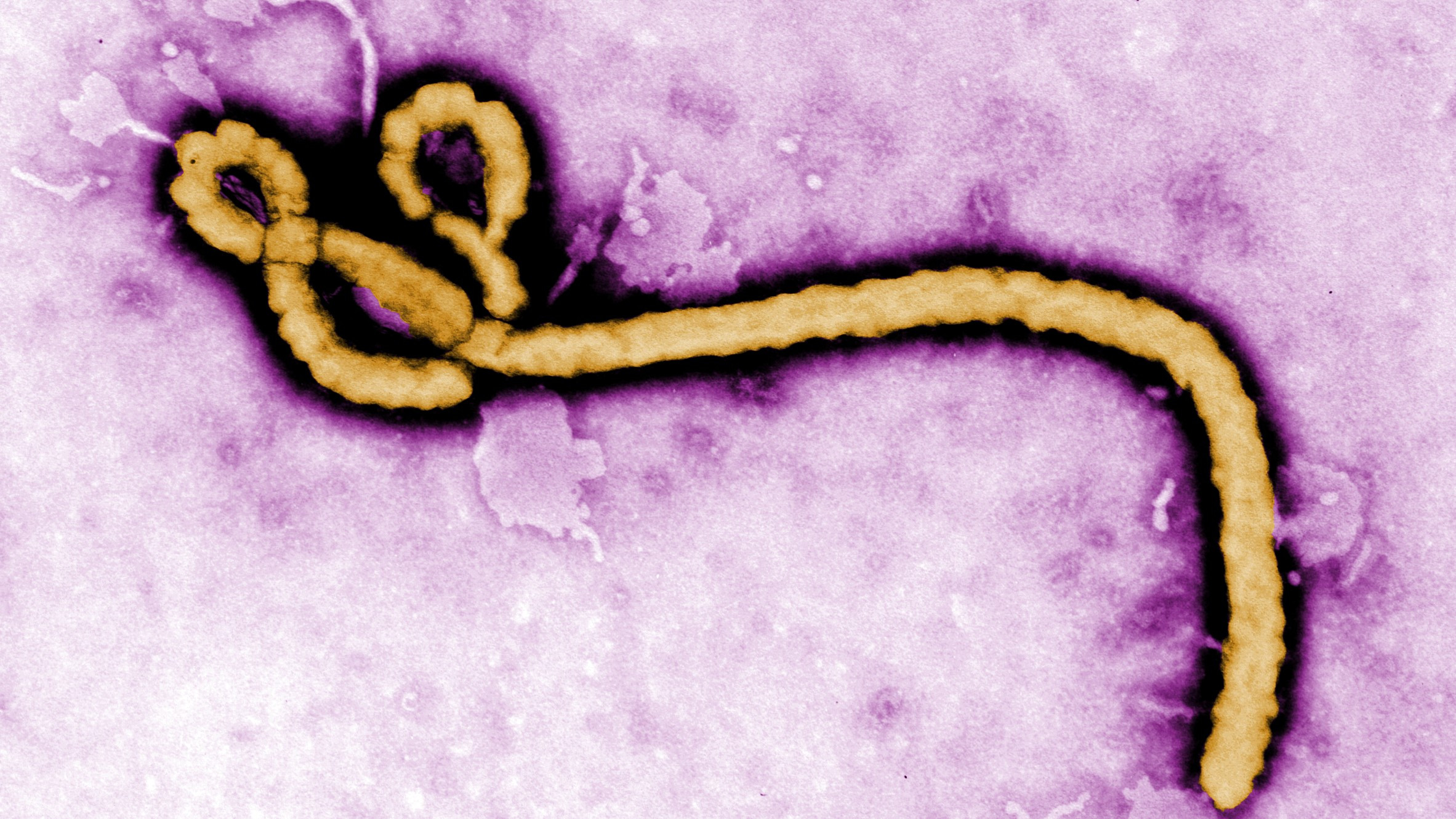 New Ebola Outbreak Kills 80 As Who Declares A Public Health Emergency