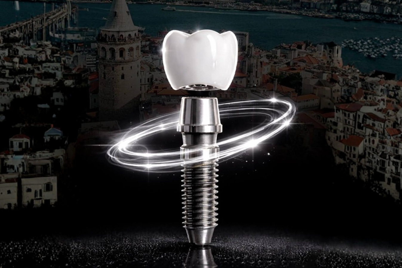 Are Dental Implants Safe? Risks, Benefits, and What the Research Says ...
