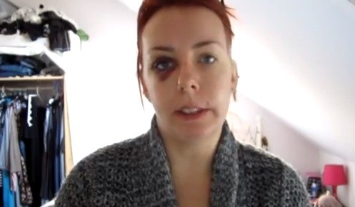 Assault Victim Rachel England Launches YouTube Video to Find Attacker ...
