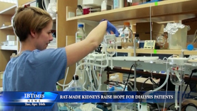 Lab-Made Rat Kidneys Raise Hopes For Dialysis Patients | IBTimes UK